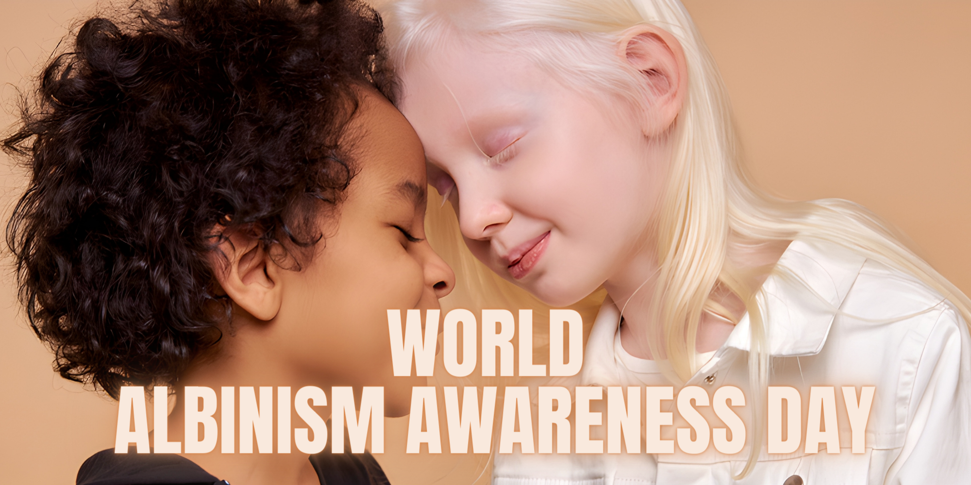 Living with Albinism: Breaking the Myths, Building Compassion - Deking ...